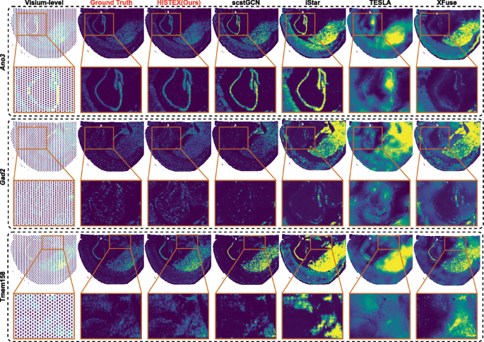 Inferring Super-Resolved Gene Expression by Integrating Histology Images and Spatial ...