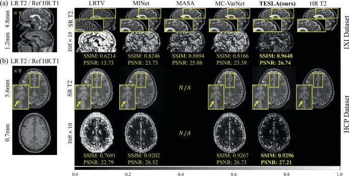 TESLA: Test-Time Reference-Free Through-Plane Super-Resolution for ...