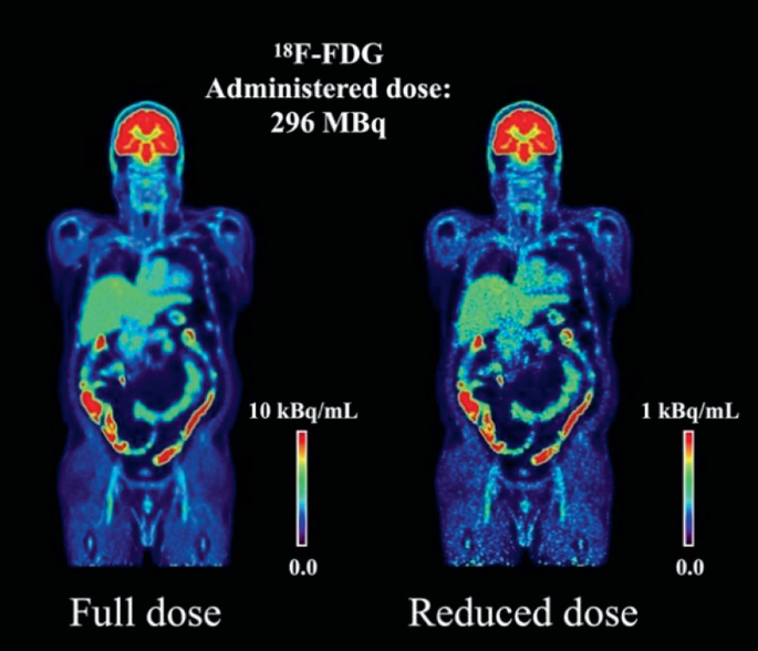 UDPET: Ultra-low Dose PET Imaging Challenge Dataset | Springer Nature ...