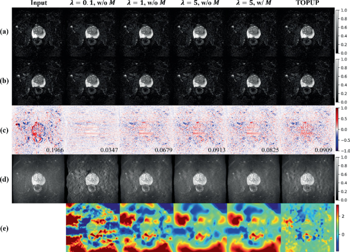 Unsupervised Learning-Based Susceptibility Artifact Correction for ...