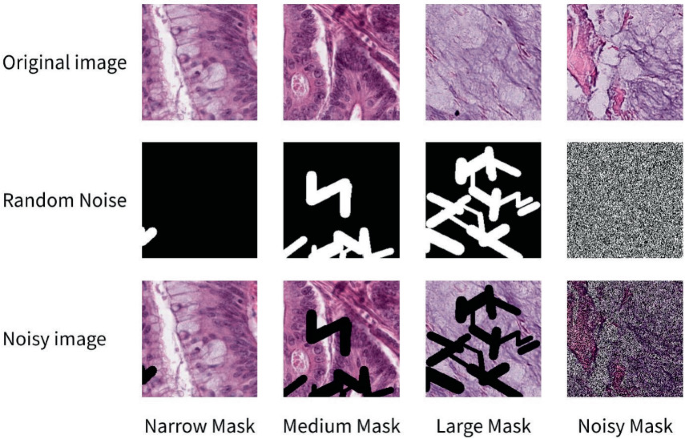 Decentralized Noise Handling in Medical Imaging: Encoder-Decoder Based ...