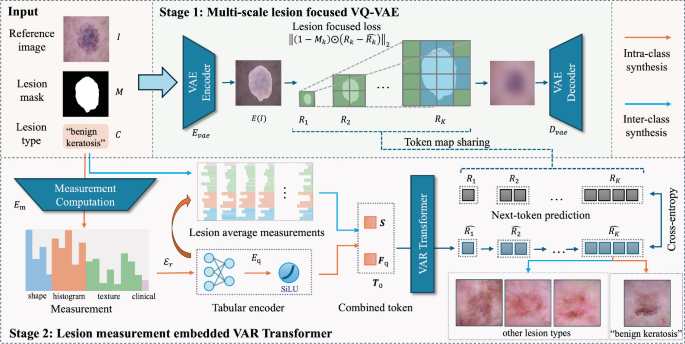 Controllable Skin Synthesis via Lesion-Focused Vector Autoregression ...