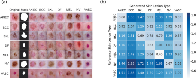 Controllable Skin Synthesis via Lesion-Focused Vector Autoregression ...