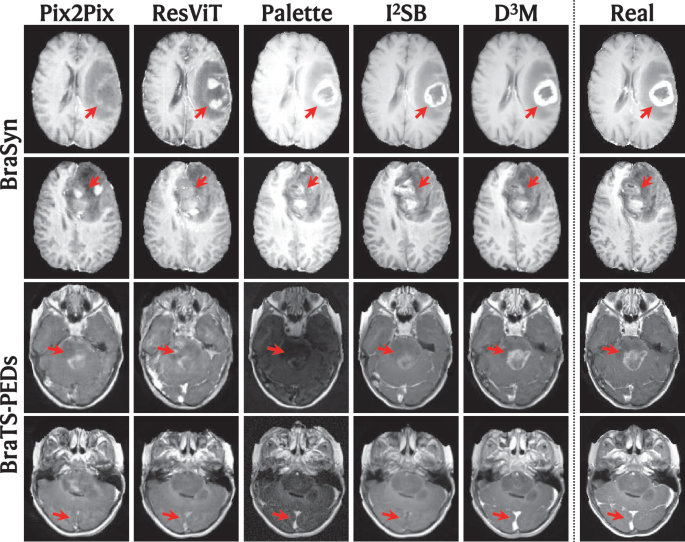 D $$^3$$ M: Deformation-Driven Diffusion Model for Synthesis of ...