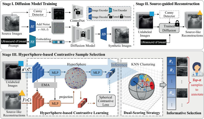 ADAptation: Reconstruction-Based Unsupervised Active Learning for Breast Ultrasound Diagnosis ...
