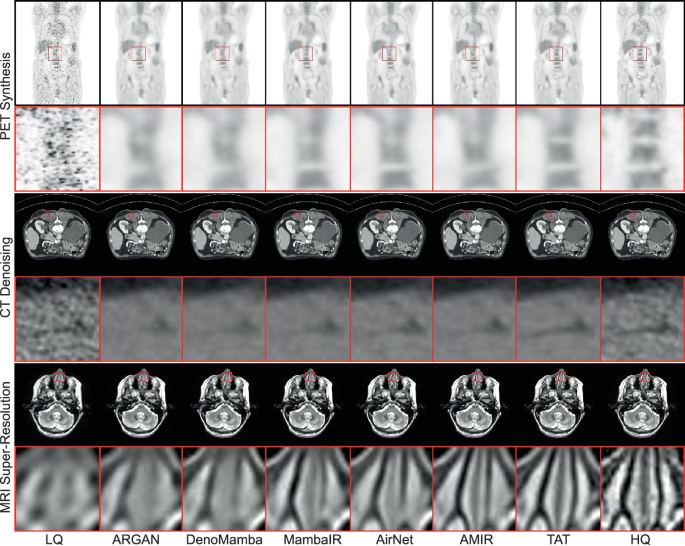 TAT: Task-Adaptive Transformer for All-in-One Medical Image Restoration ...