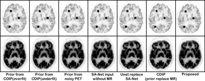 Bowsher Prior Enhanced Unsupervised PET Image Denoising | SpringerLink