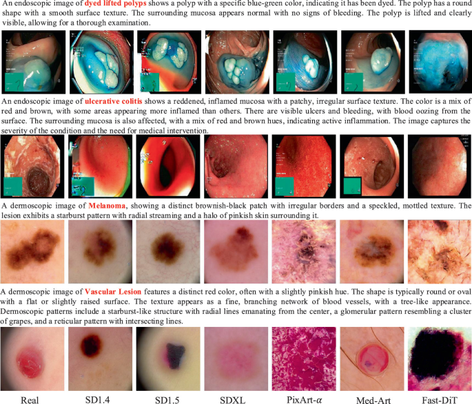Med-Art: Diffusion Transformer for 2D Medical Text-to-Image Generation ...