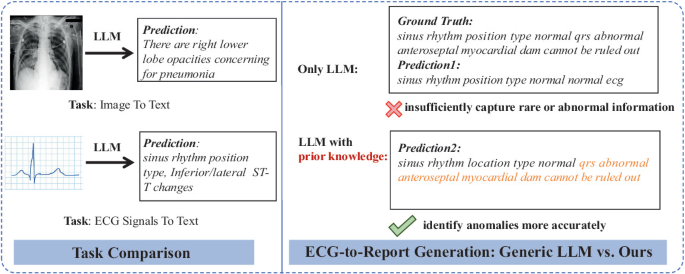 ECG Report Generation with Diagnostic Knowledge Enhanced Prompt Learning | SpringerLink