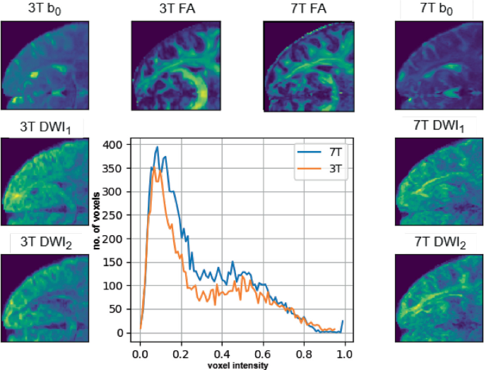 FastDTI: A 3D Scale-Arbitrary Super-Resolution Autoencoder Residual Dense Network for DTI ...