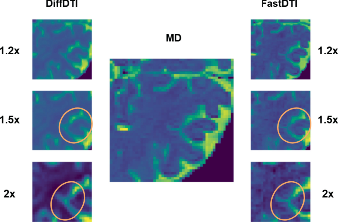 FastDTI: A 3D Scale-Arbitrary Super-Resolution Autoencoder Residual Dense Network for DTI ...