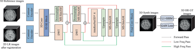 2D to 3D MR Image Super-Resolution Using Cross-Contrast Guidance ...