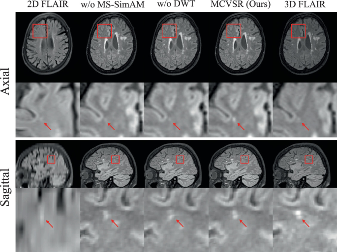 2D to 3D MR Image Super-Resolution Using Cross-Contrast Guidance ...