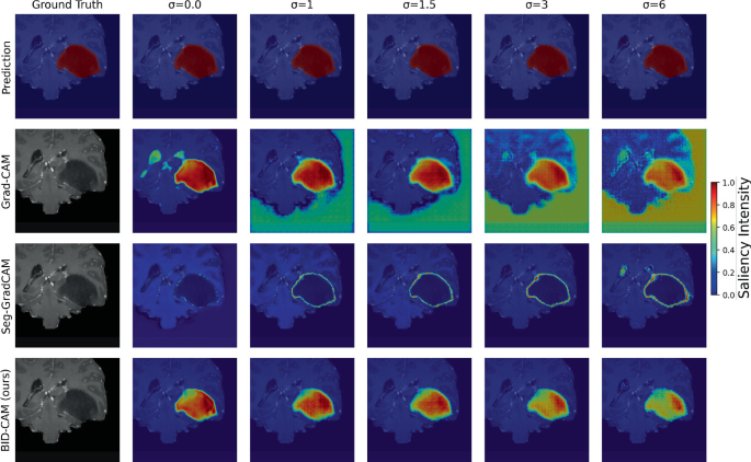 The Interplay Between Explainability and Differential Privacy in ...