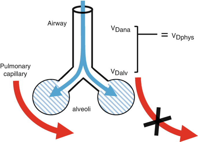 Ventilation | SpringerLink