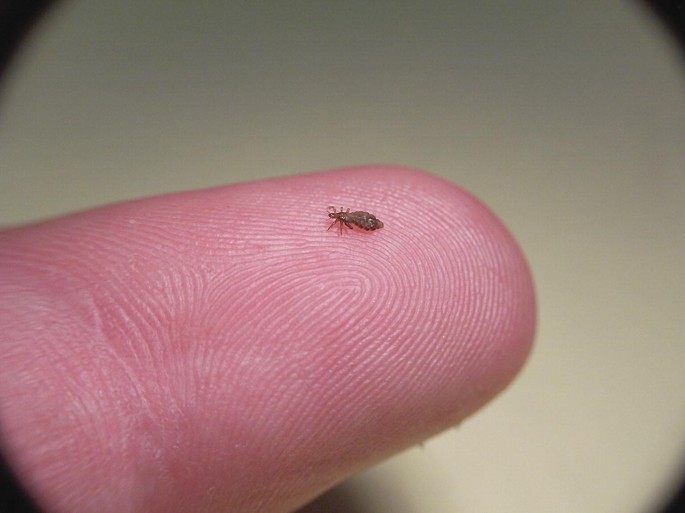 Louse-Borne Diseases | Springer Nature Link (formerly SpringerLink)