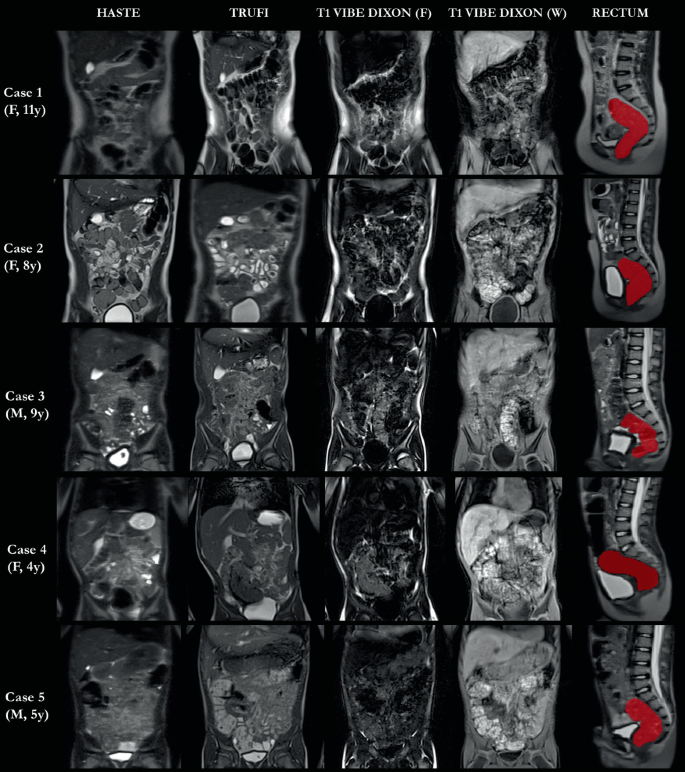 Towards a Comprehensive Morphological, Dynamic and Functional MRI ...