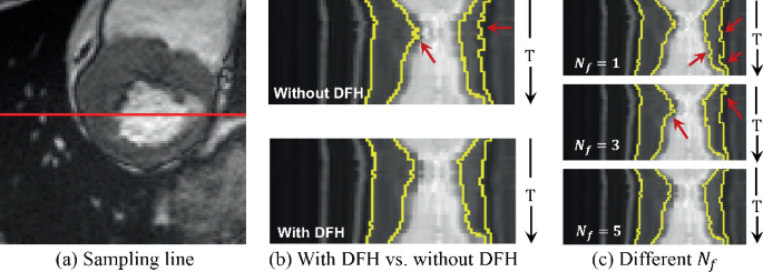 MCM: Mamba-Based Cardiac Motion Tracking Using Sequential Images in MRI | SpringerLink