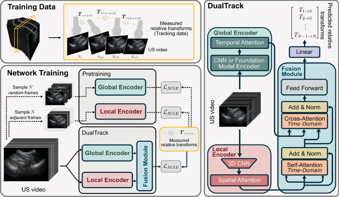 DualTrack: Sensorless 3D Ultrasound needs Local and Global Context ...