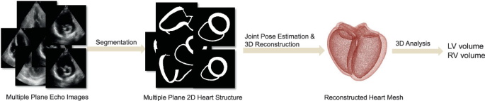 3D Heart Reconstruction from Sparse Pose-Agnostic 2D Echocardiographic ...