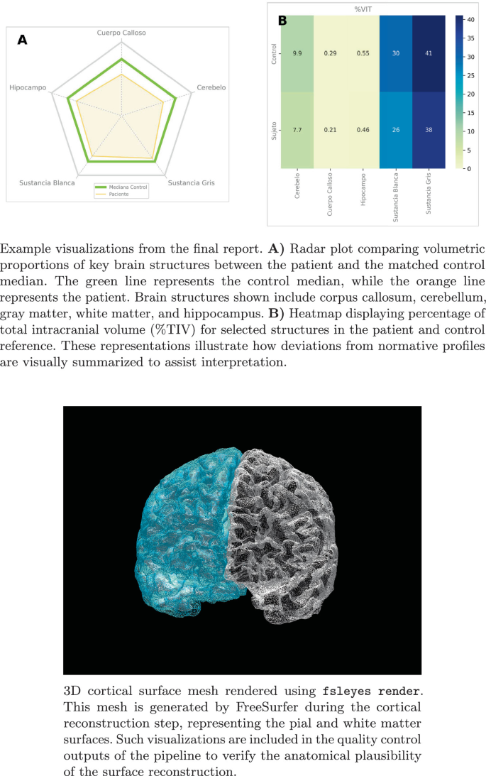 Automated Structural Brain Analysis from T1-W Images | Springer Nature Link