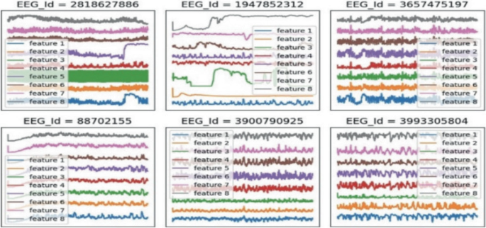 NeuroInsight: Automated EEG Pattern Analysis for Critical Care ...