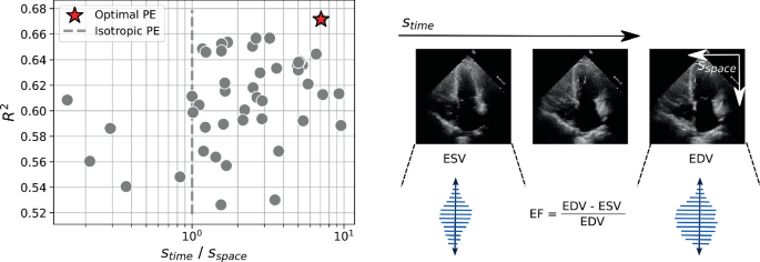 Anisotropic Fourier Features for Positional Encoding in Medical Imaging ...