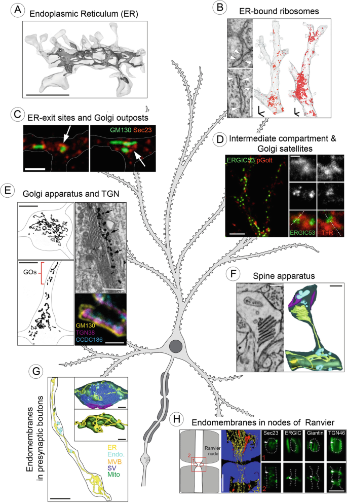 The Neuronal Golgi Network and Its Acolytes | SpringerLink
