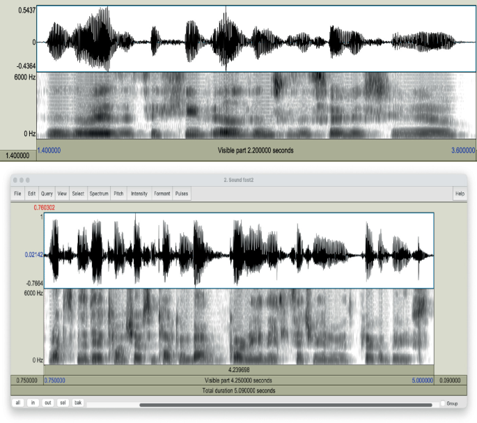 Speech Pattern Variability in the Speech Accessibility Project ...