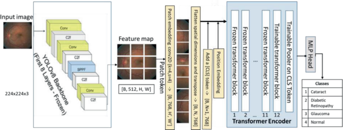 YOLO-ViT: A Hybrid Deep Learning Model for Eye Disease Classification ...
