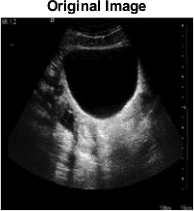 Computer-Aided Diagnosis in Uterus Imaging | SpringerLink