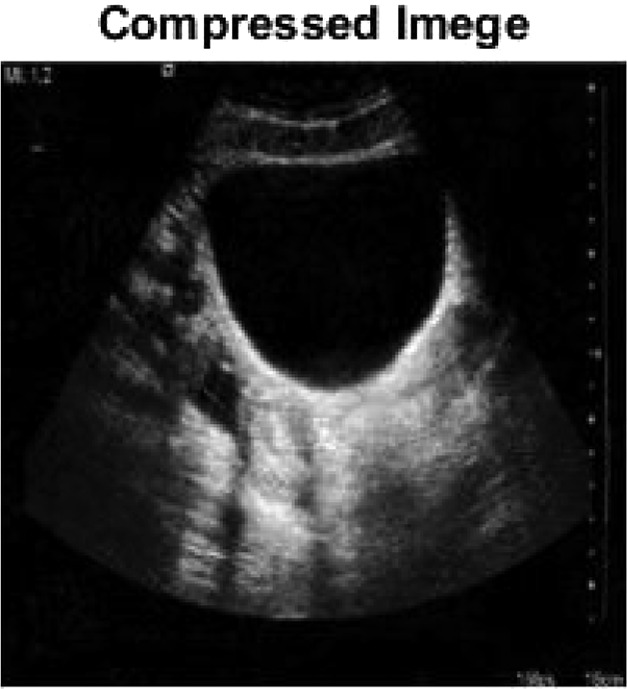 Computer-Aided Diagnosis in Uterus Imaging | SpringerLink