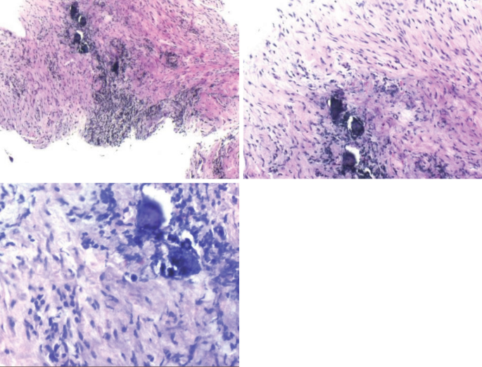Oral Cavity | Springer Nature Link (formerly SpringerLink)