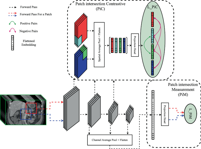 PiMPiC: An Overlap-Aware Contrastive Learning Framework for 3D Patch ...