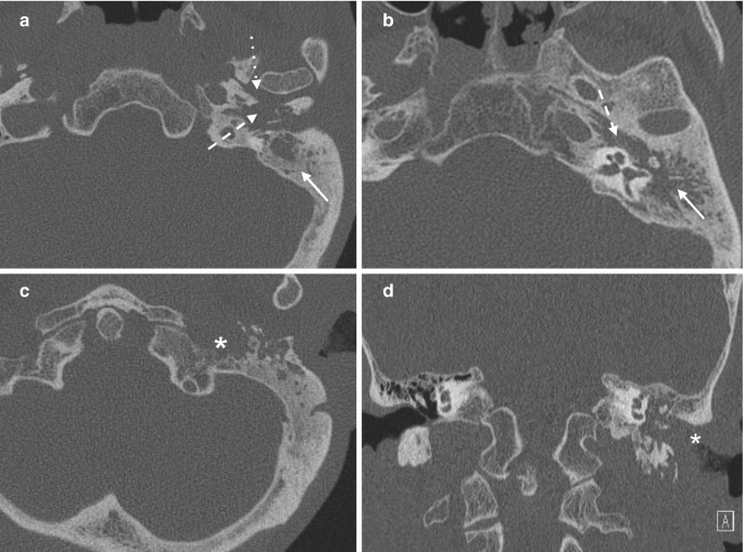Acquired Pathology of the External Ear | Springer Nature Link (formerly ...