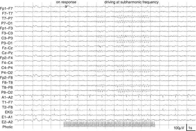 Activation Procedures | Springer Nature Link