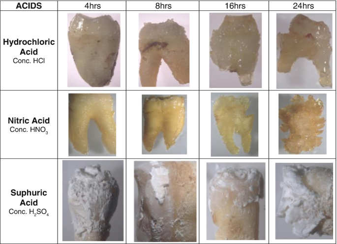 On-Field Assessment and Recovery of Dental Remains in Complex Scenarios ...