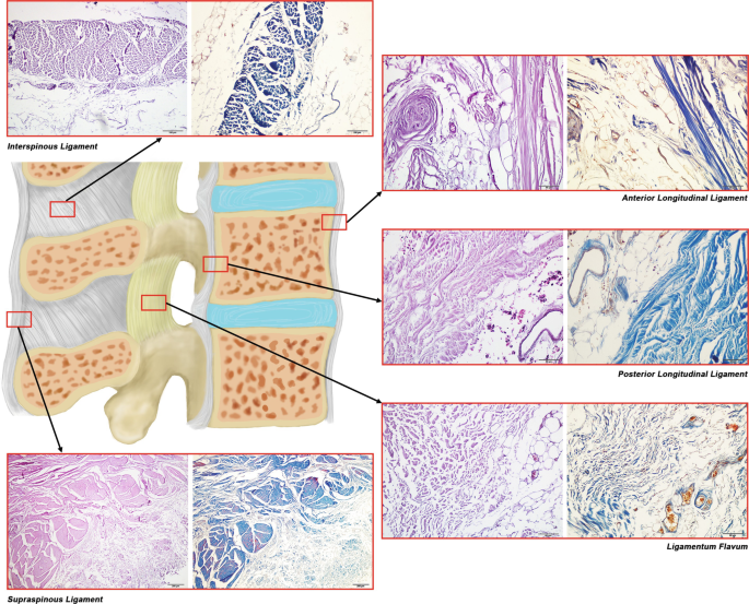 Histogenesis of the Spinal Ligaments (Light and Electron Microscopy ...