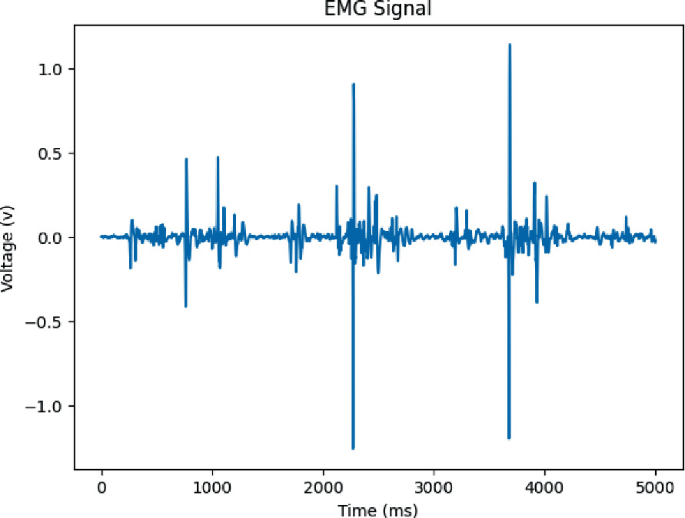 Obtaining and Analyzing EMG Signals for the Detection of Anomalies and ...