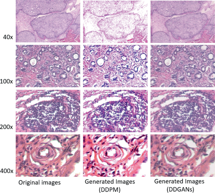 Hybrid Diffusion Models for Scalable and High-Quality Medical Image ...