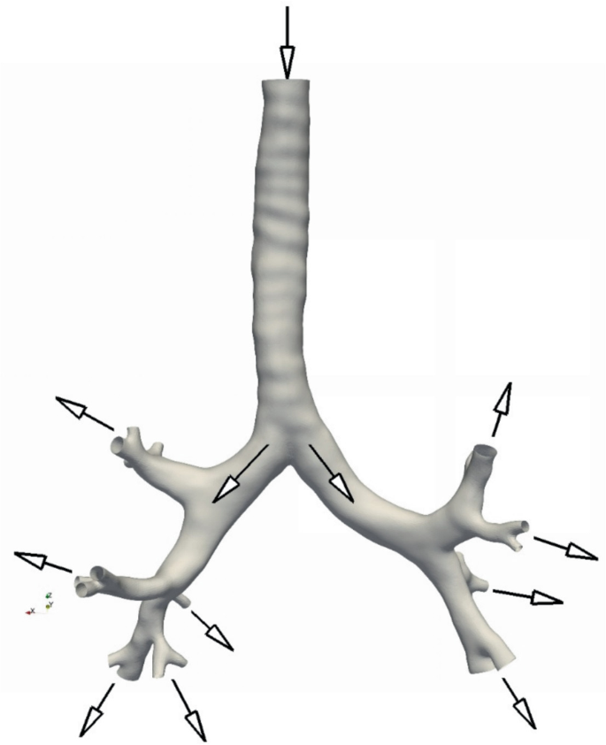 Numerical Analysis of Airflow in a Patient-Specific 3D Reconstructed ...