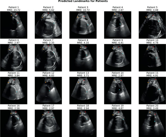 Adversarially Fine-Tuned Self-supervised Framework for Automated ...