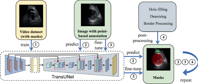 Pseudo-label Enhanced TransUNet for Robust Landmark Localization in ...
