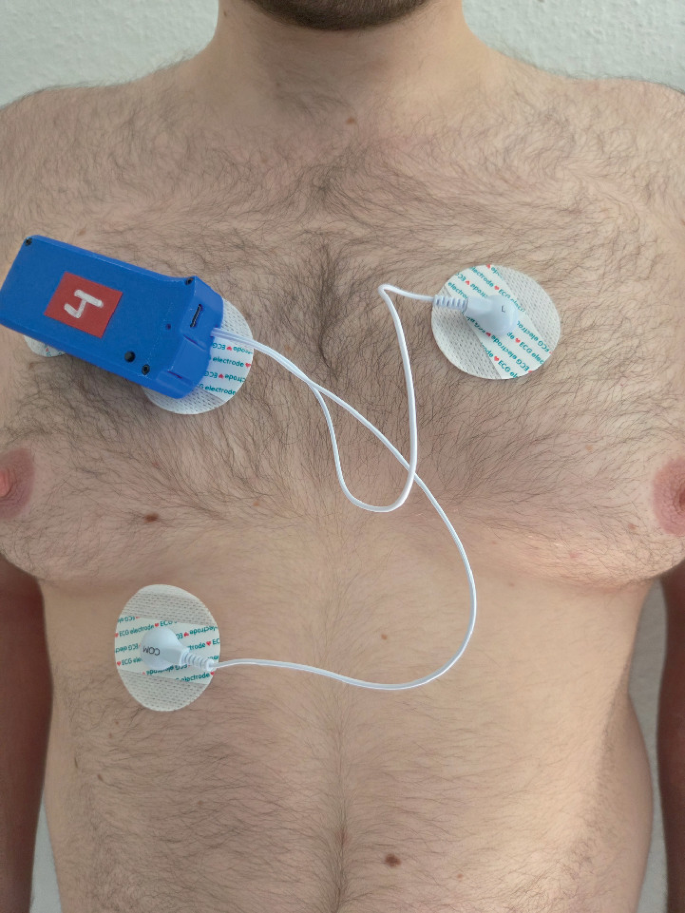 Real-Time ECG and HRV Monitoring in Handball Using a Low-Cost Wearable ...