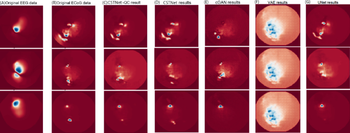 CSTNet: A Generative Framework for EEG-to-ECoG Mapping via Optimal ...