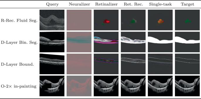 Conquering the Retina: Bringing Visual in-Context Learning to OCT ...