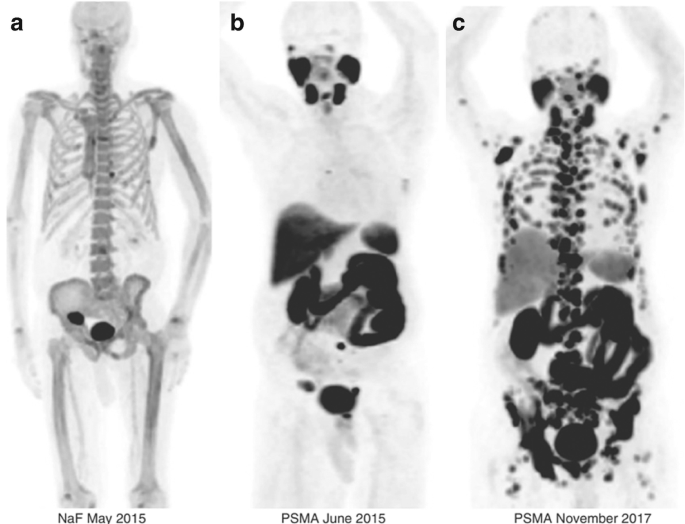 Nuclear Medicine in the Musculoskeletal System | Springer Nature Link