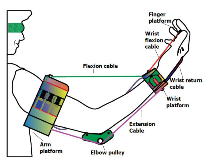 Design and Experimental Performance of ASSIST-EW Cable-Driven Assisting ...
