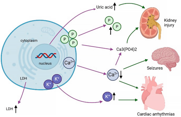 Tumor Lysis Syndrome | SpringerLink
