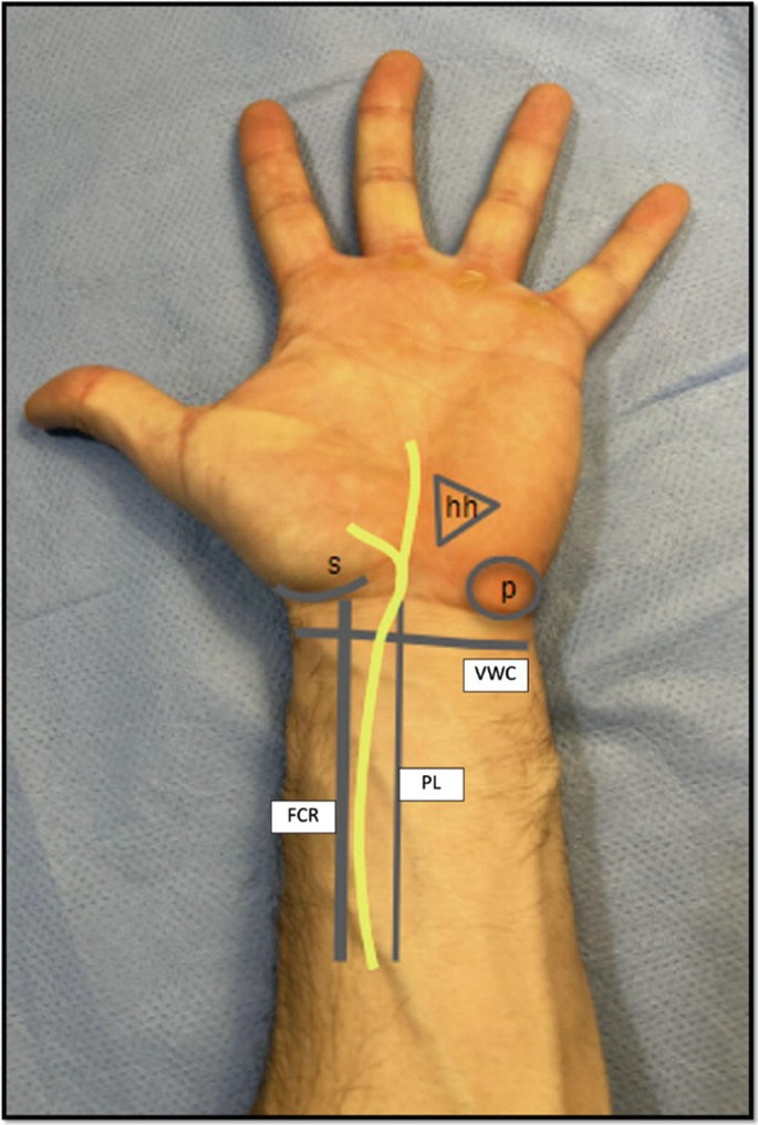 Physical Examination of the Wrist and Hand | SpringerLink